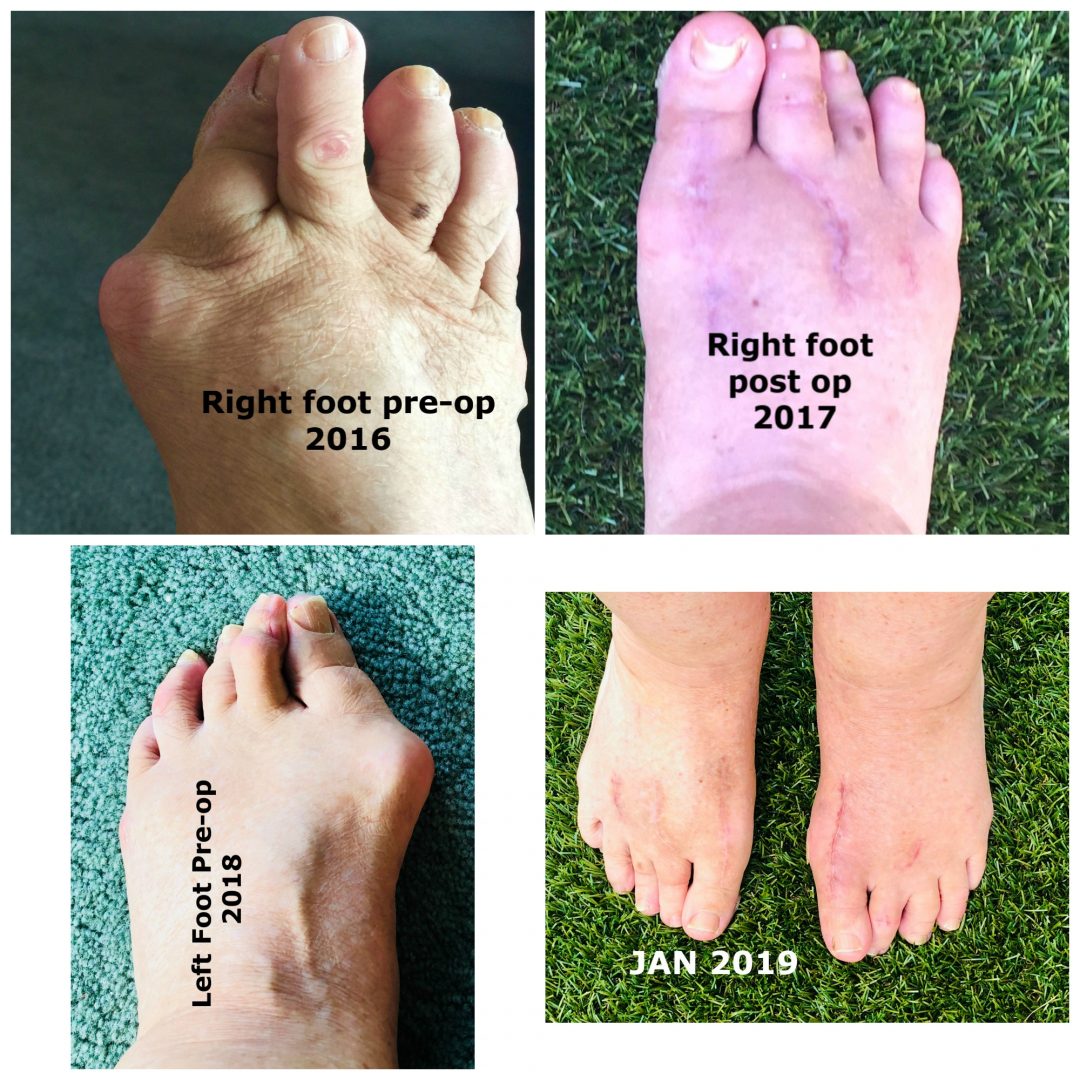 foot collage caryl 2020 | Caryl Westmore