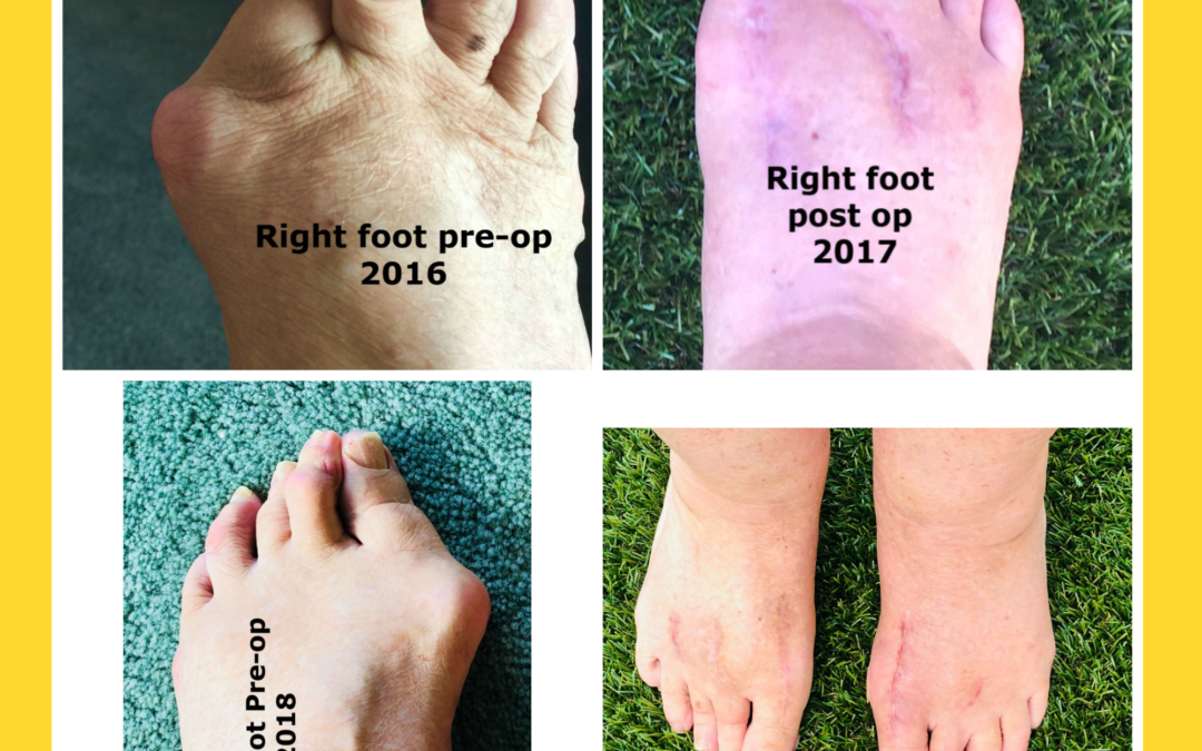 foot collagezcaryl 2021 | Caryl Westmore